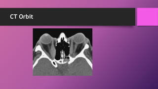 Management of thyroid eye disease | PPTX