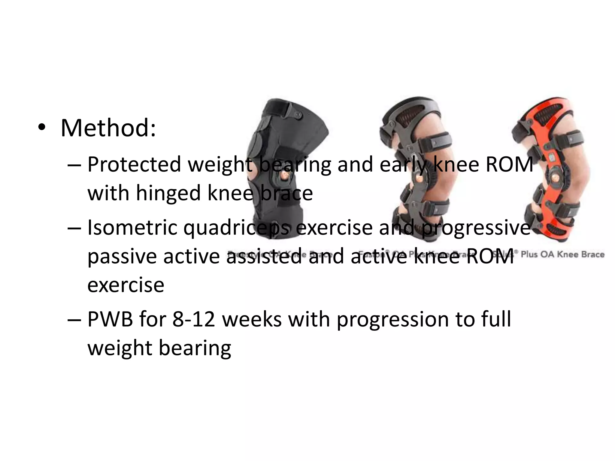 Management of tibial plateau fracture | PPTX