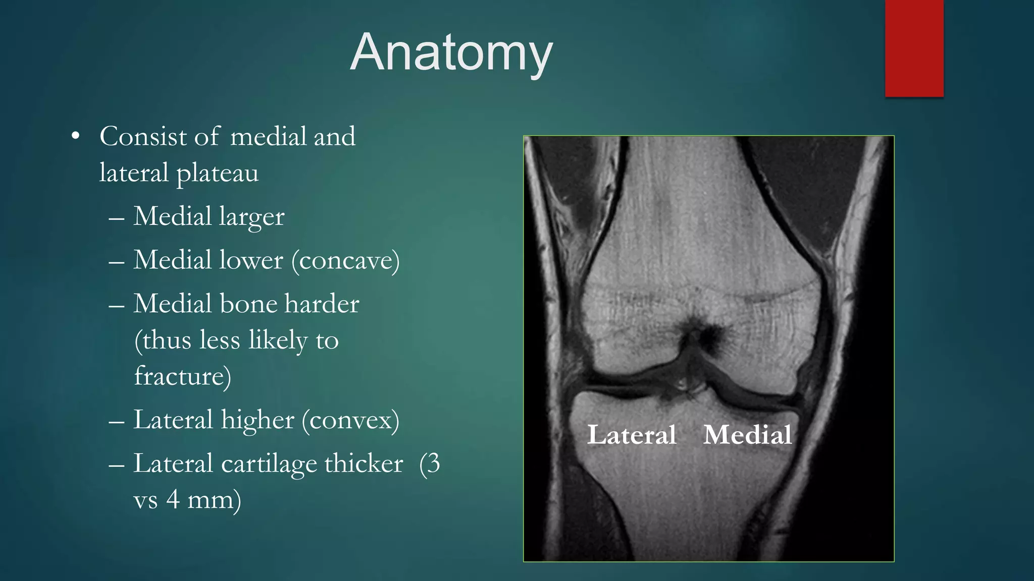 Management of tibial plateau fracture | PPTX