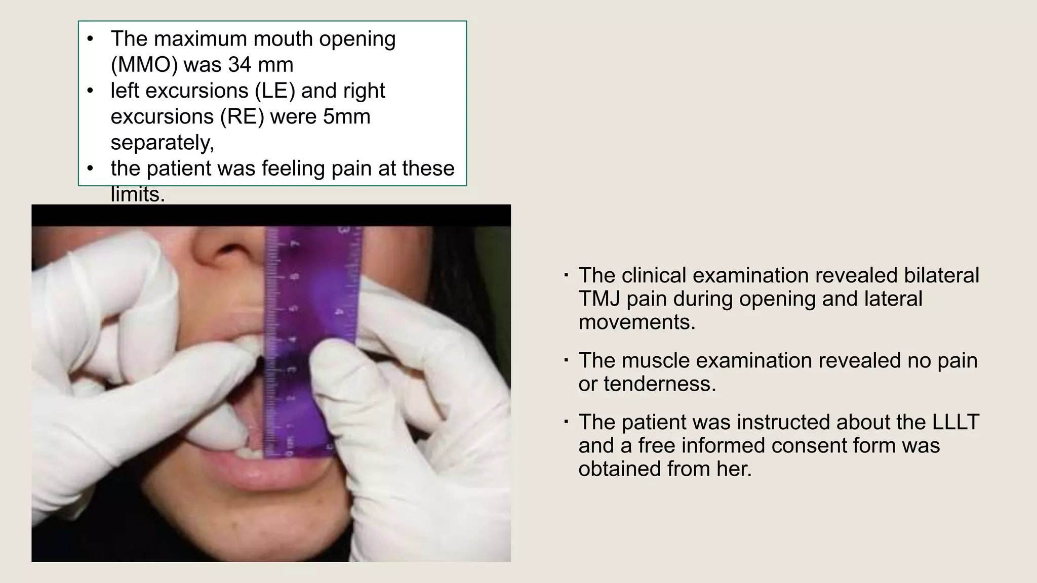Management of tmd symptoms with photobiomodulation therapy | PPTX