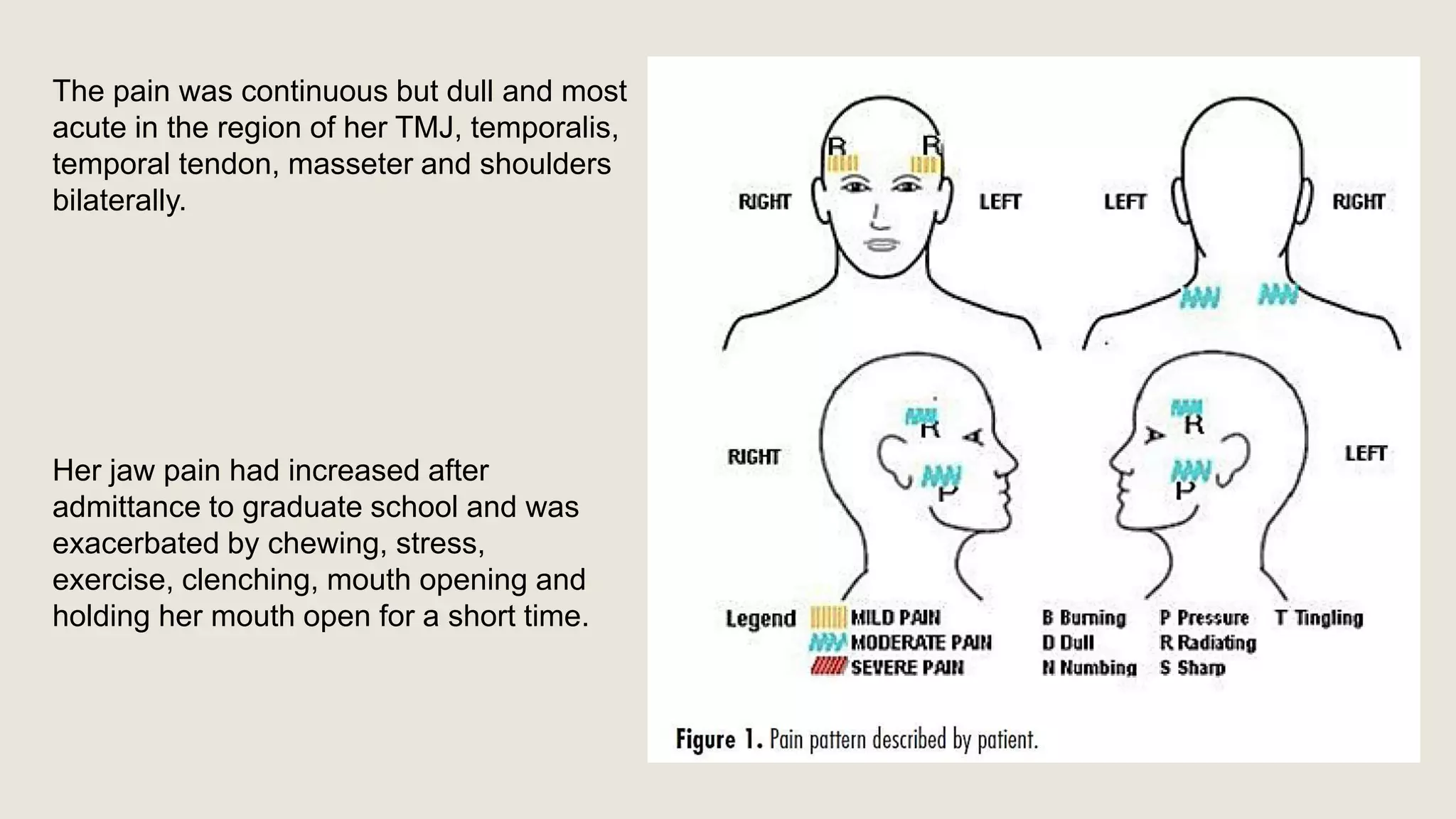 Management of tmd symptoms with photobiomodulation therapy | PPTX