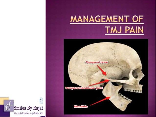 Management of TMJ pain | PPTX