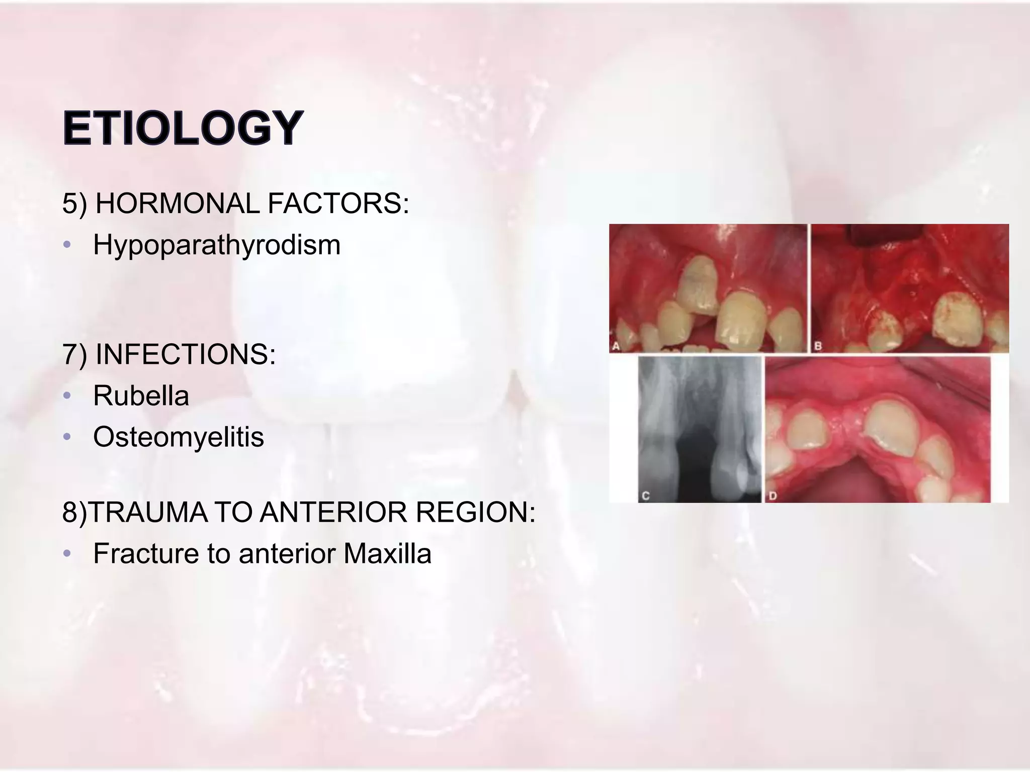 Management of tooth agenesis in orthodontics | PPTX
