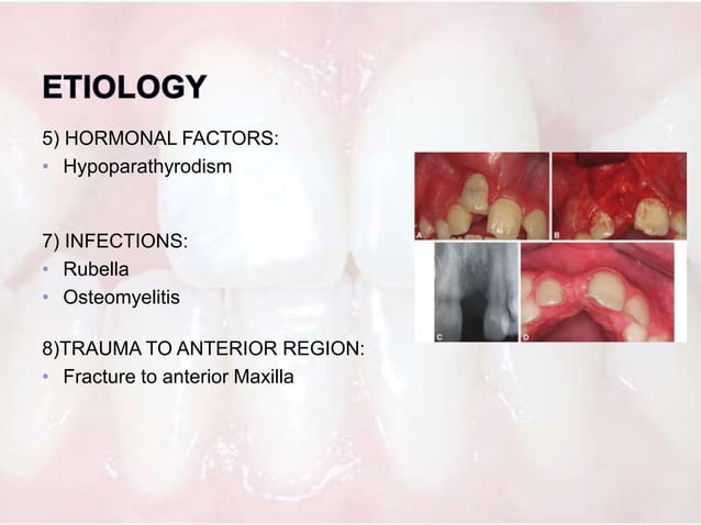 Management of tooth agenesis in orthodontics | PPTX | Dental Health ...
