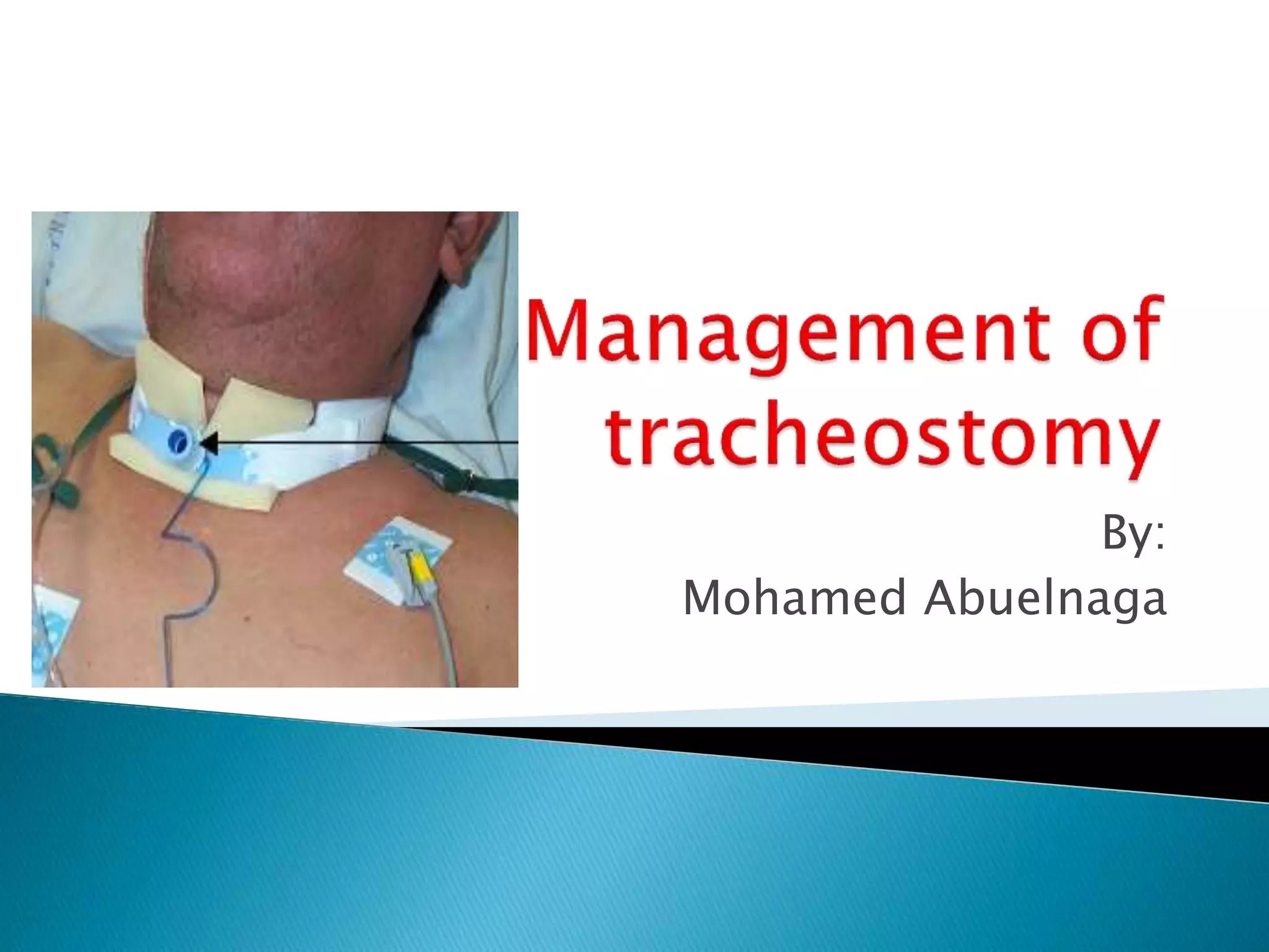 Management of tracheostomy | PPTX