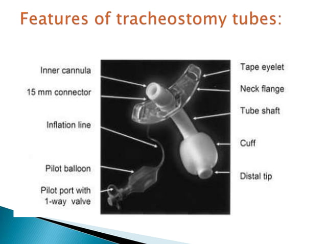Management of tracheostomy | PPTX