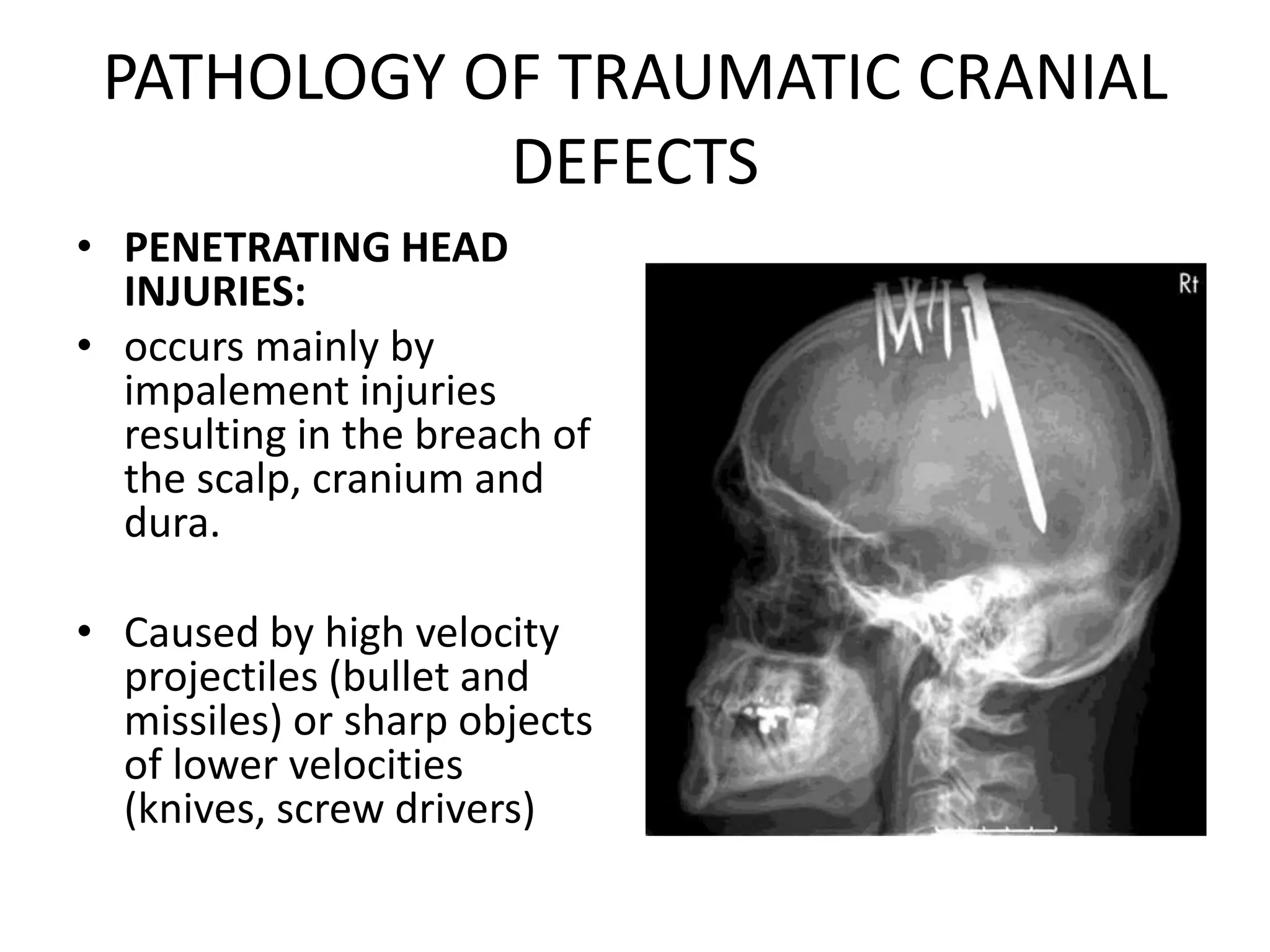 Management of traumatic cranial defect (PATHOLOGY) | PPTX