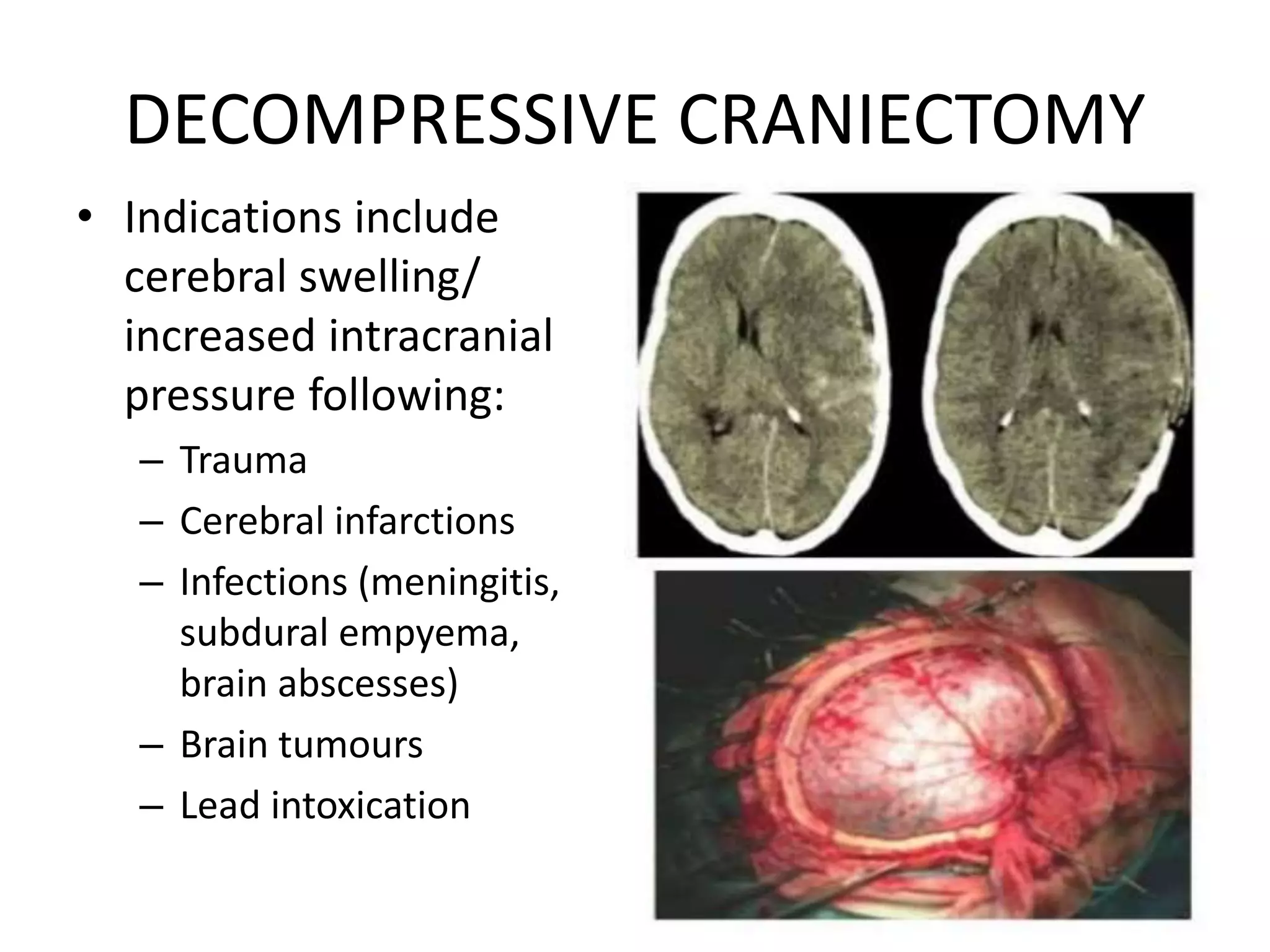 Management of traumatic cranial defect (PATHOLOGY) | PPTX
