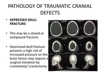 Management of traumatic cranial defect (PATHOLOGY) | PPTX