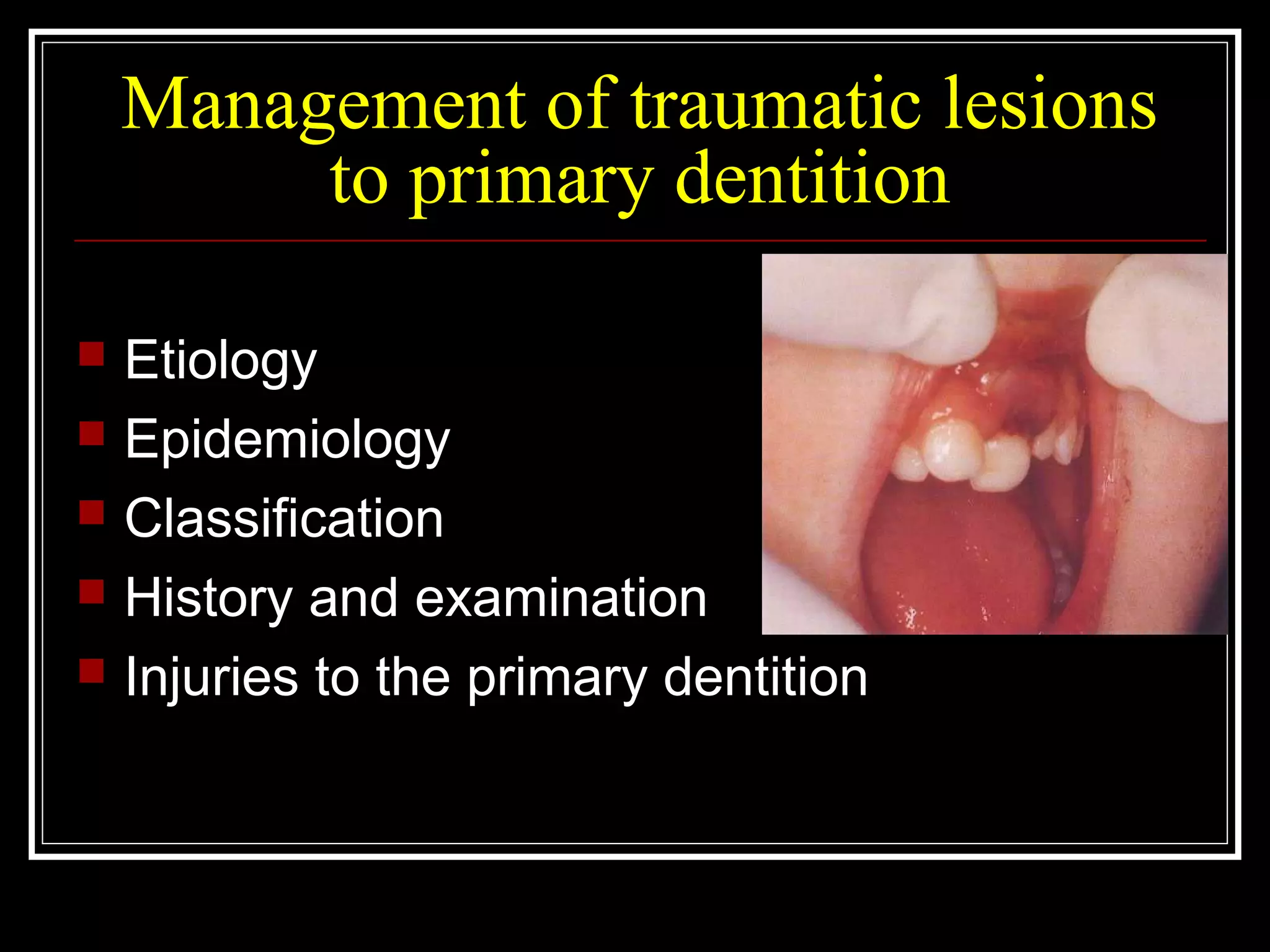 Management of traumatic lesions to primary dentition | PPT