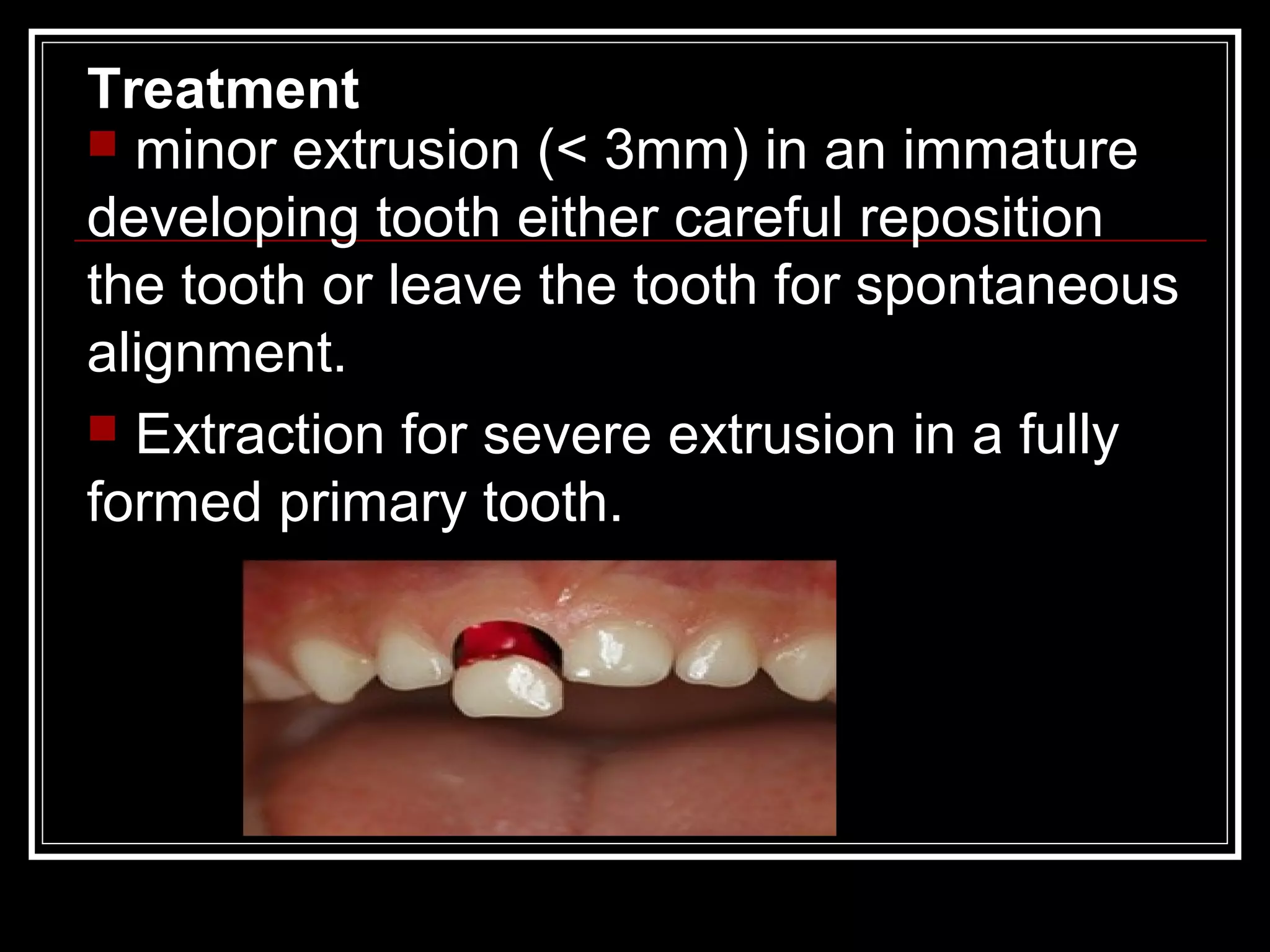 Management of traumatic lesions to primary dentition | PPT