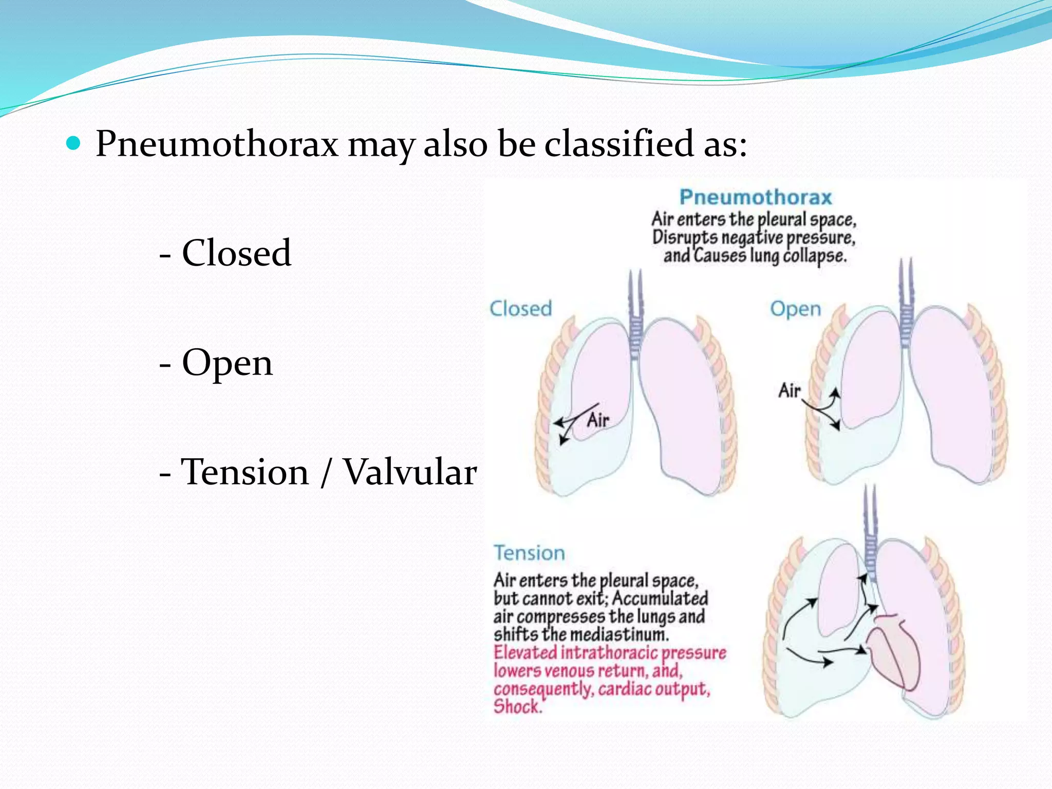 Management of traumatic pneumothorax and haemothorax | PPTX