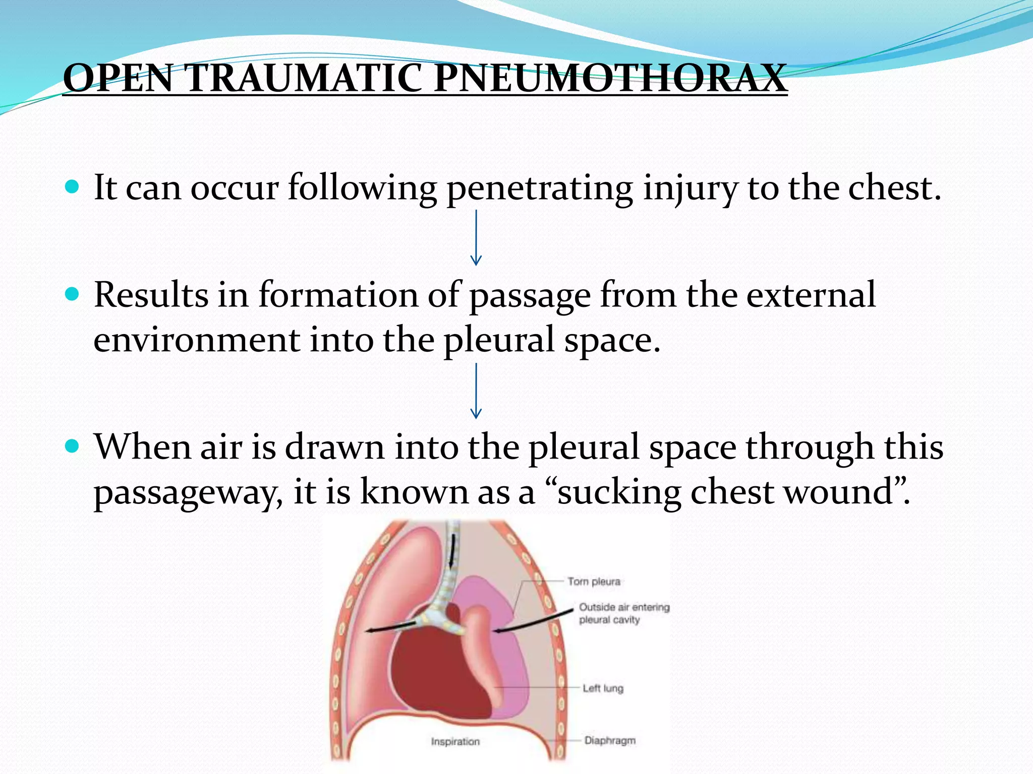 Management of traumatic pneumothorax and haemothorax | PPTX