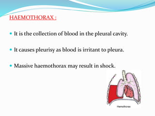 Management of traumatic pneumothorax and haemothorax | PPTX