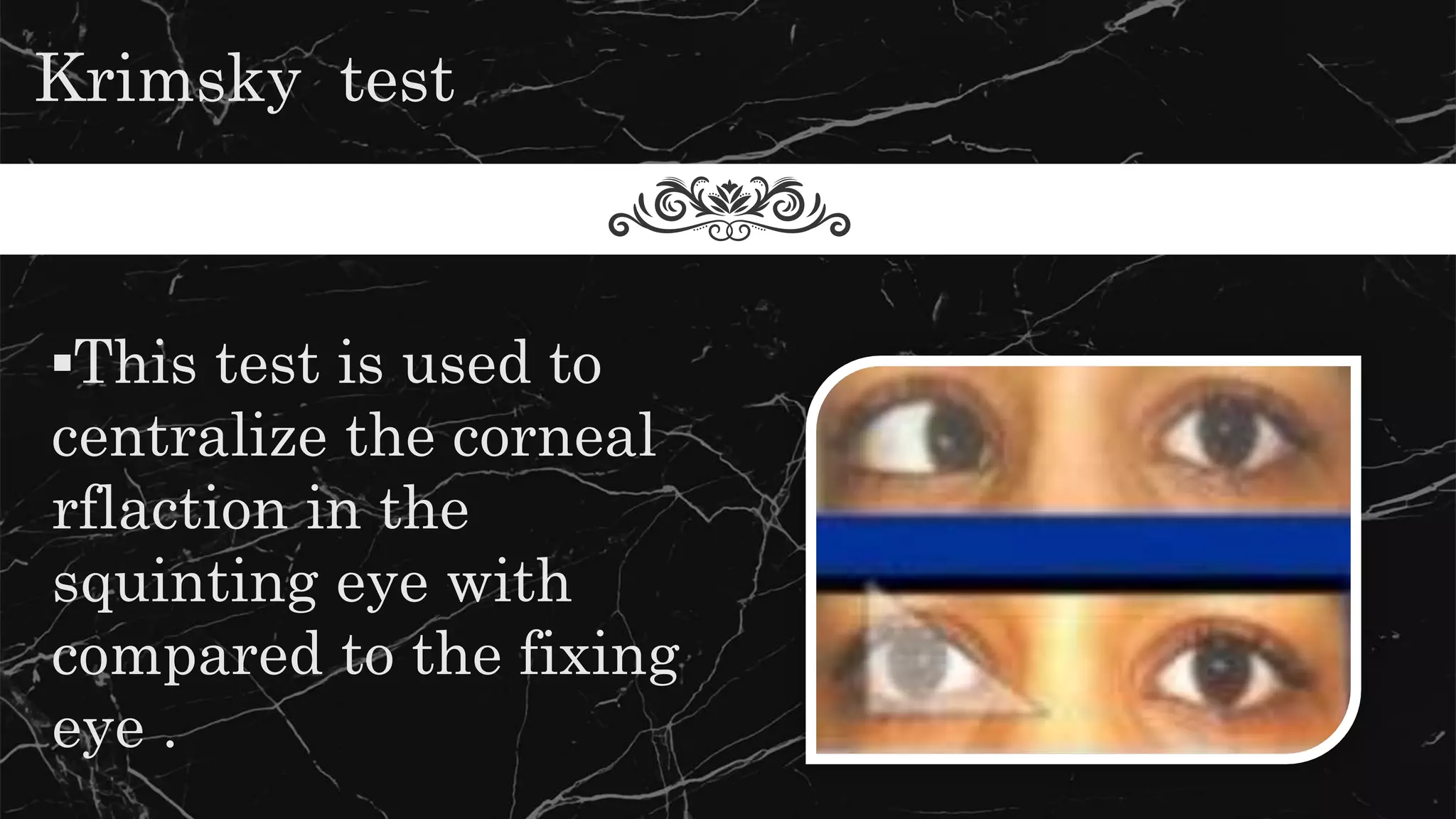 Management of tropia by prisms.pptx