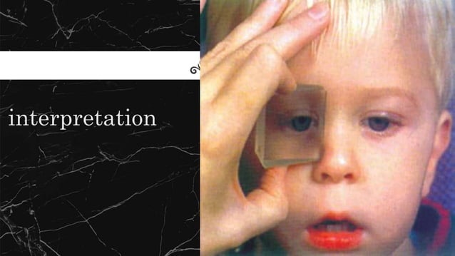 Management of tropia by prisms.pptx | Eye and Vision Conditions ...