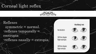 Management of tropia by prisms.pptx