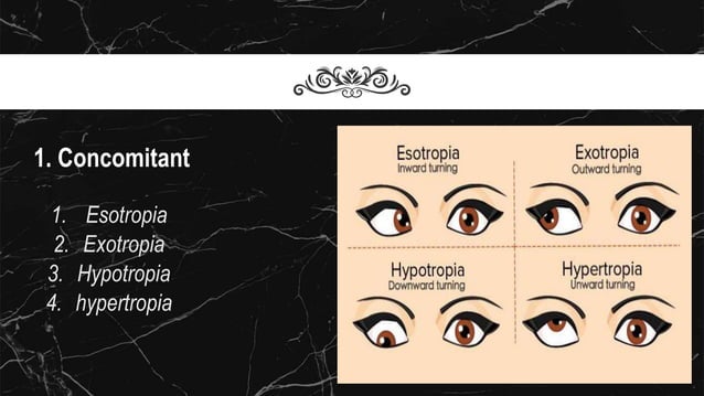 Management of tropia by prisms.pptx | Eye and Vision Conditions ...