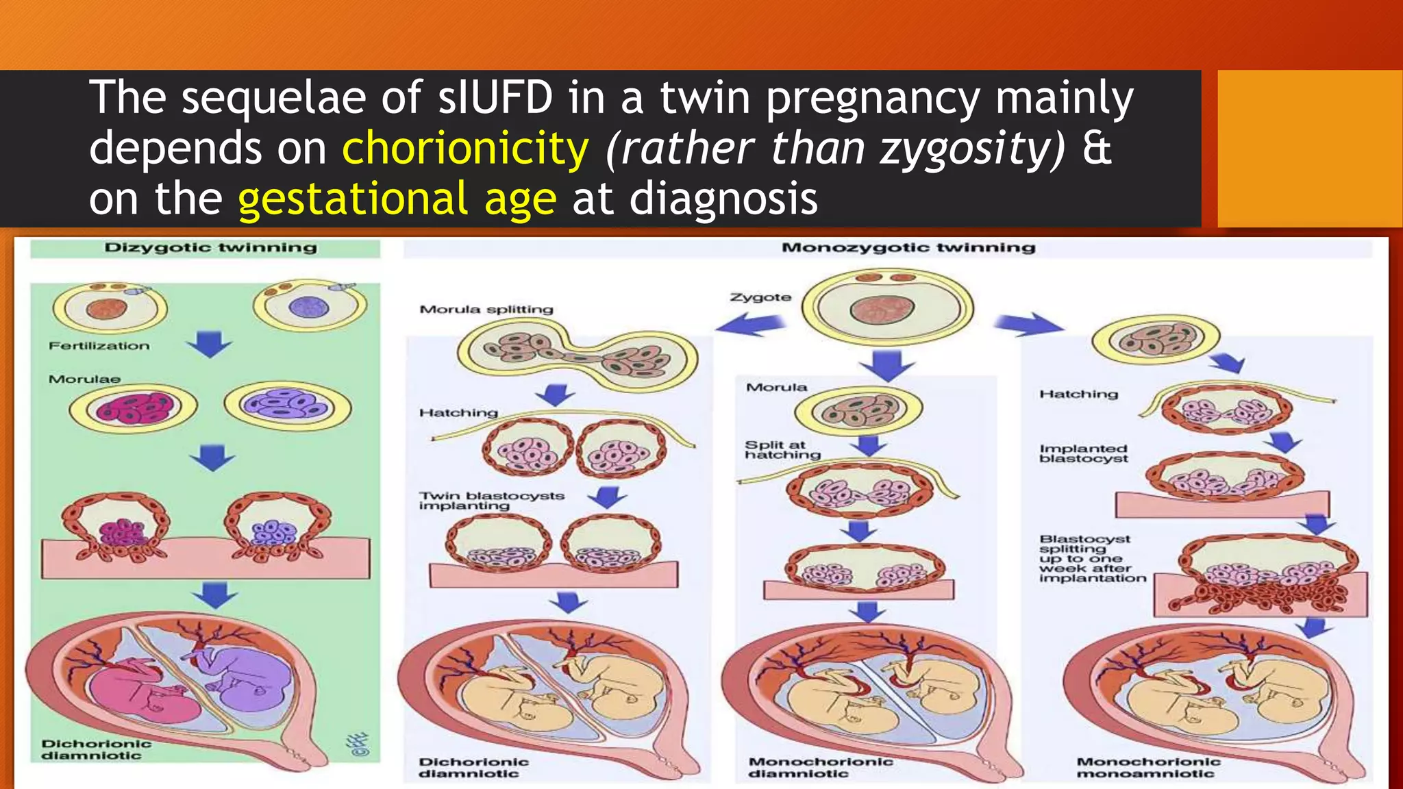 Management Of Twin Pregnancy With Single Fetal Demise Obstetrics October 2019 Pptx