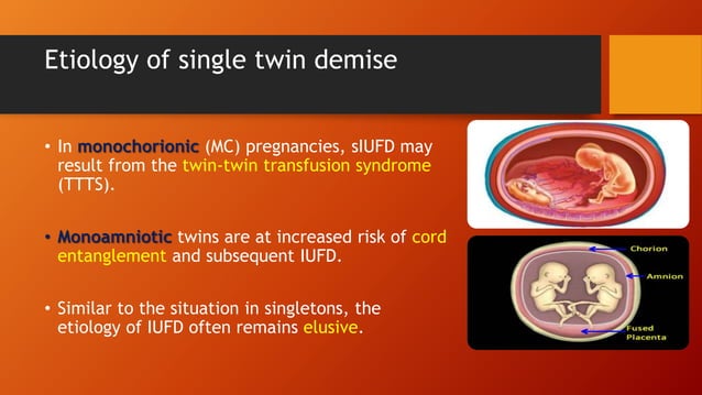 Management of twin pregnancy with single fetal demise; Obstetrics - October 2019 | PPTX ...