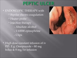 Management of upper gi bleed | PPT