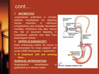 Management of upper gi bleed | PPTX | Digestive Disorders | Diseases and Conditions
