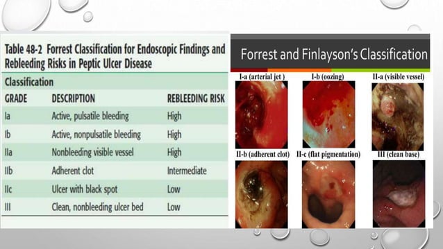 Management of upper gi bleeding | PPTX | Blood Disorders | Diseases and ...
