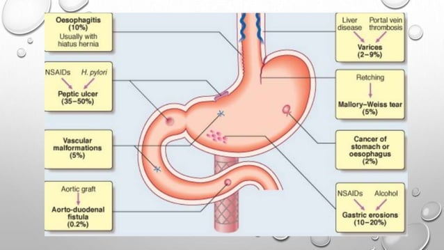 Management of upper gi bleeding | PPTX | Blood Disorders | Diseases and ...