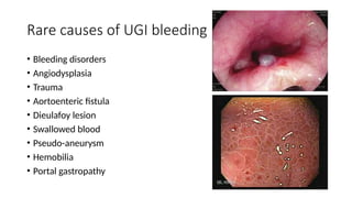 Management of upper GI bleeding-undergraduates.pptx