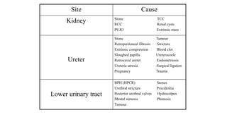 Management of upper urinary tract obstruction | PPTX