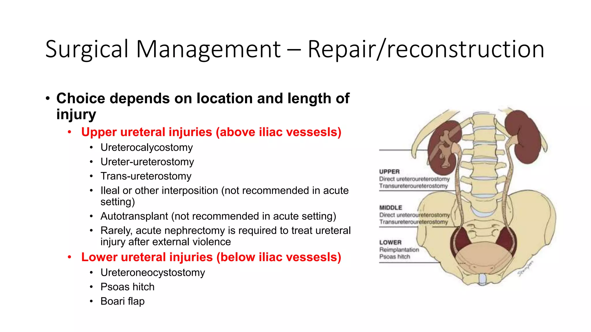 Management of Ureteric Injury.pptx