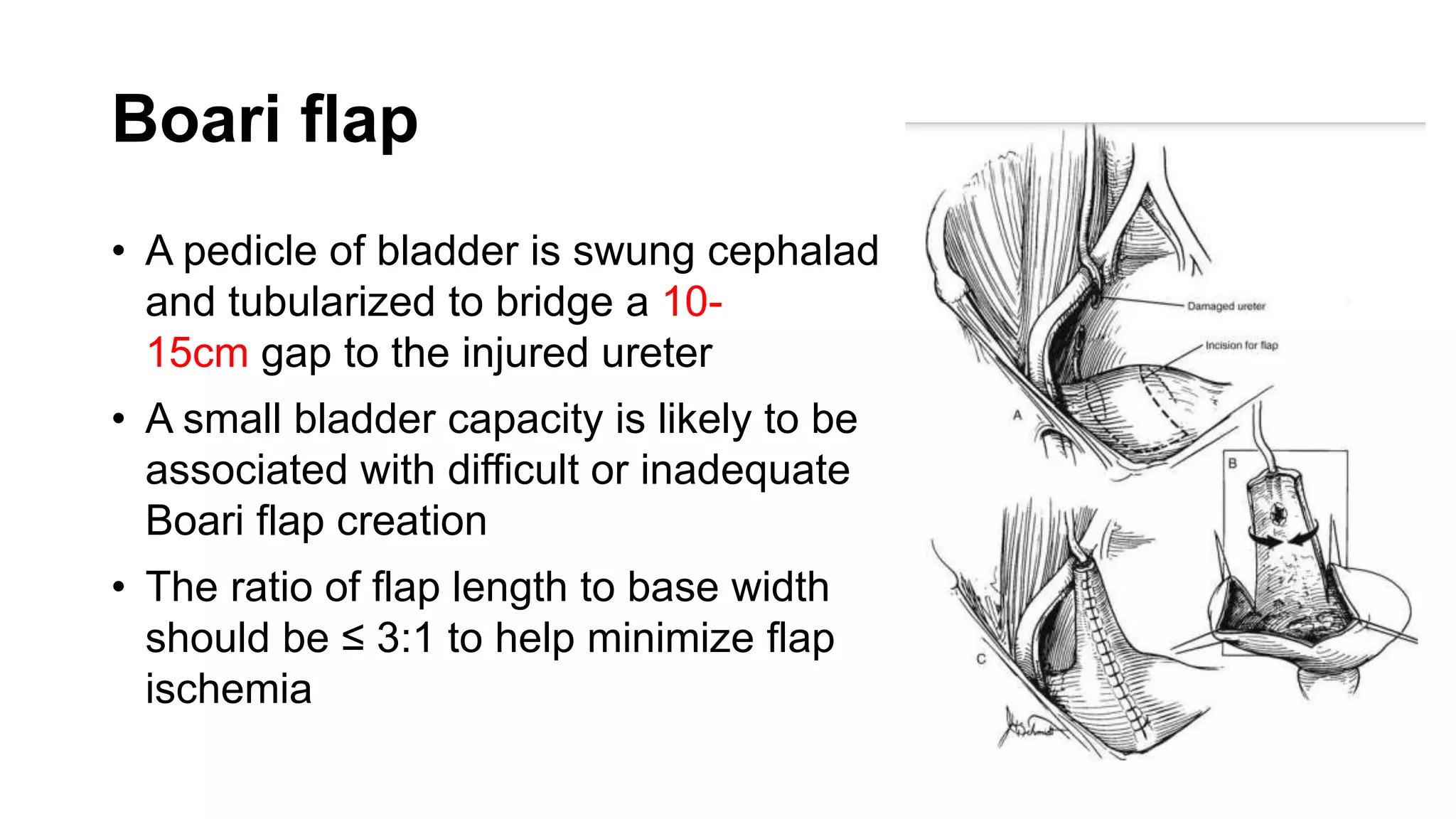 Management of Ureteric Injury.pptx