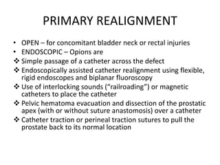 Management of urethral injury | PPTX