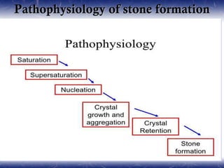 Management of urolithiasis in children | PPT