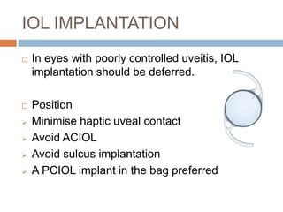 Management of Uveitic Cataract | PPTX