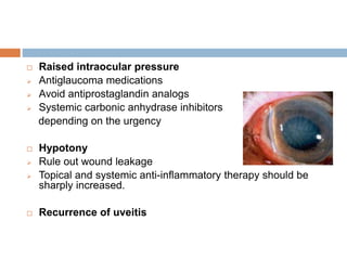 Management of Uveitic Cataract | PPTX