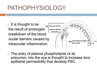 Management of Uveitic Cataract | PPTX