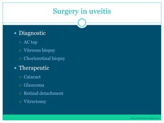 Management of uveitis | PPTX