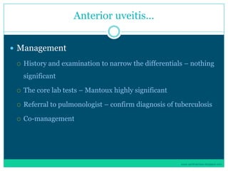 Management of uveitis | PPTX
