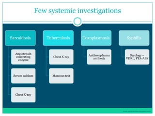 Management of uveitis | PPTX
