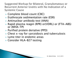 Management of uveitis | PPTX
