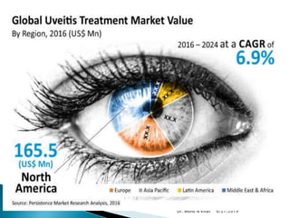 Management of uveitis | PPTX