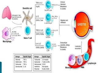 Management of uveitis | PPTX