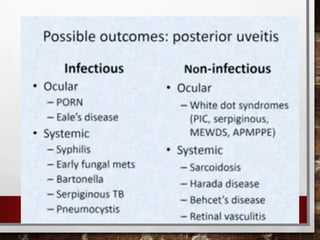 Management of Uveitis | PPTX