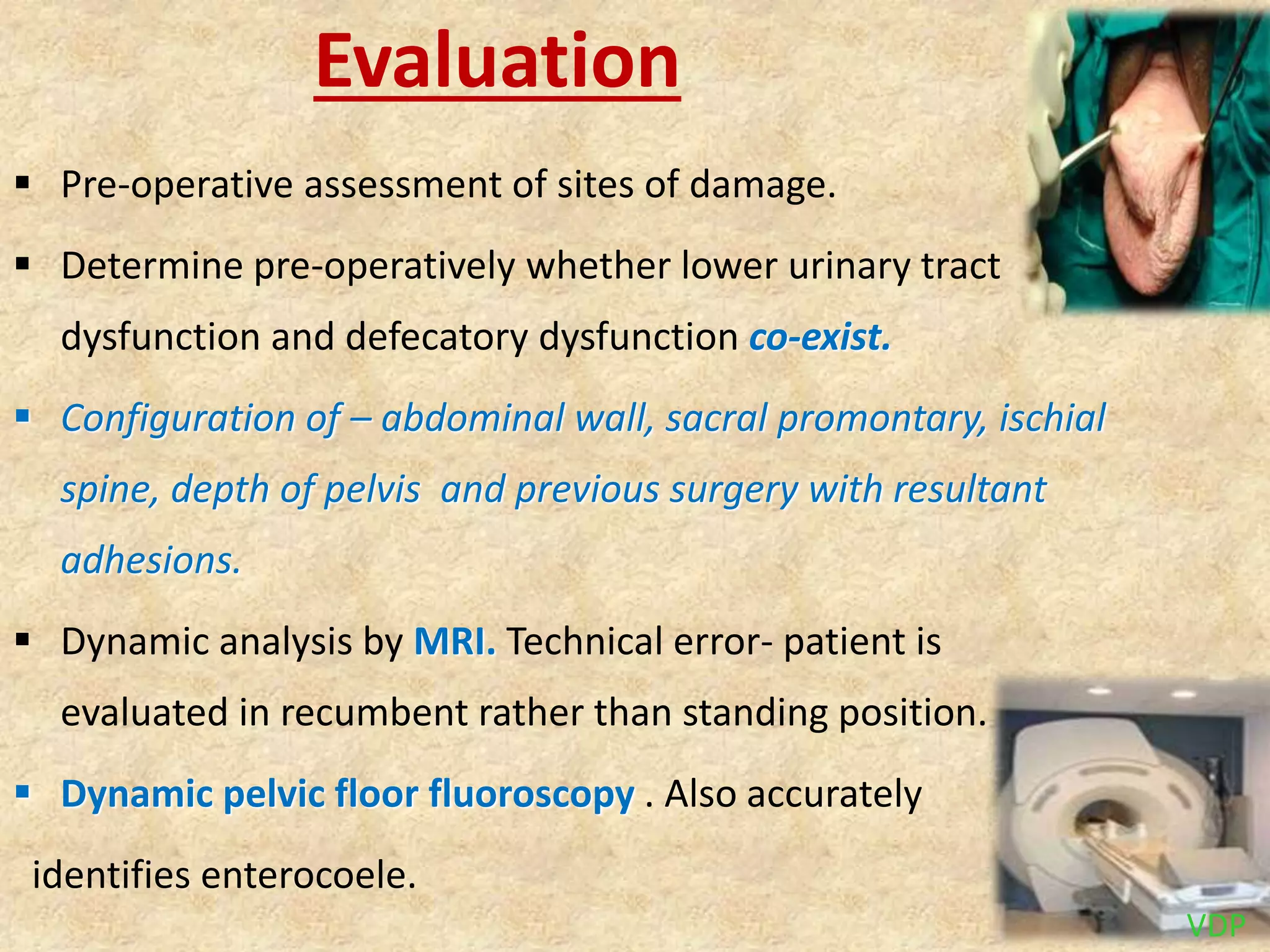 MANAGEMENT OF VAULT PROLAPSE BY DR SHASHWAT JANI | PPTX