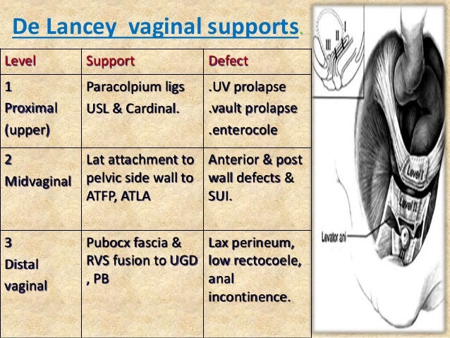 MANAGEMENT OF VAULT PROLAPSE BY DR SHASHWAT JANI