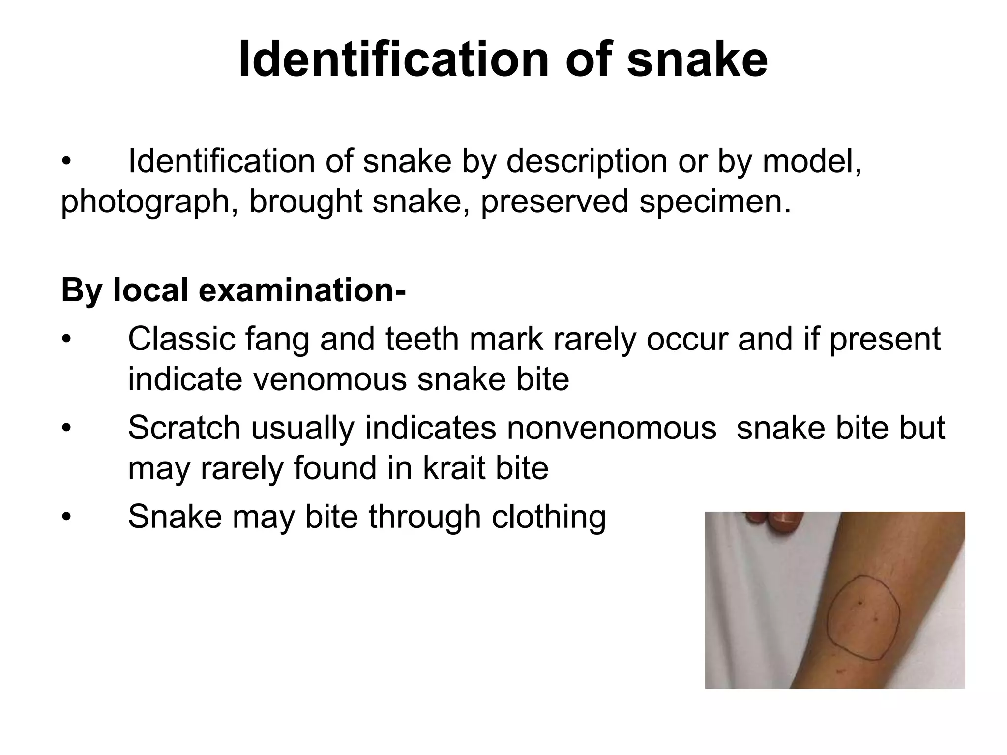 Management of venomous snake bite | PPT