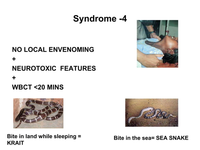 Management of venomous snake bite | PPT