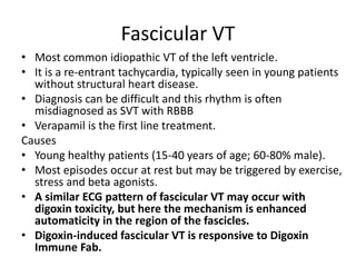 Management of ventricular tachyarrythmias | PPTX
