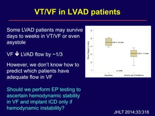 Management of ventricular tachycardia in advanced heart failure | PPT